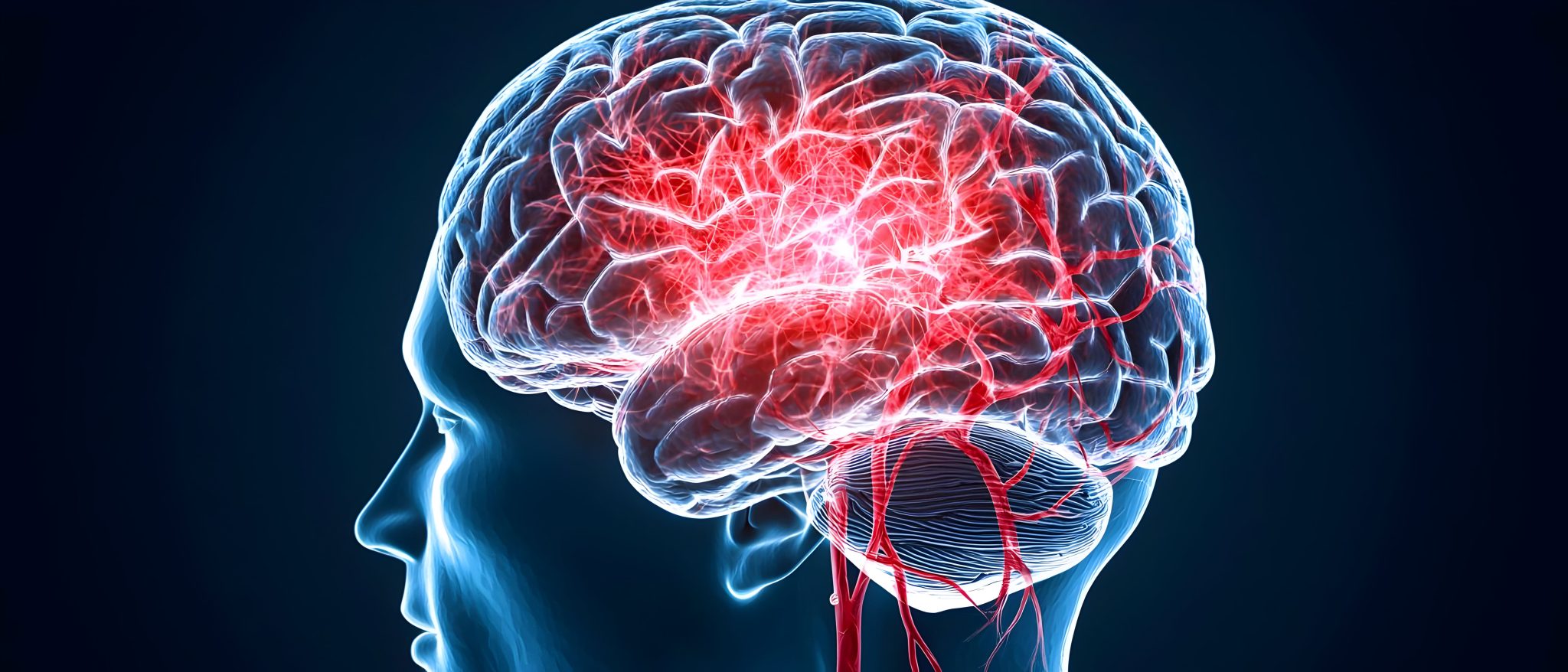 Placas de ateroma: O que são e como prevenir - Centro Radiológico